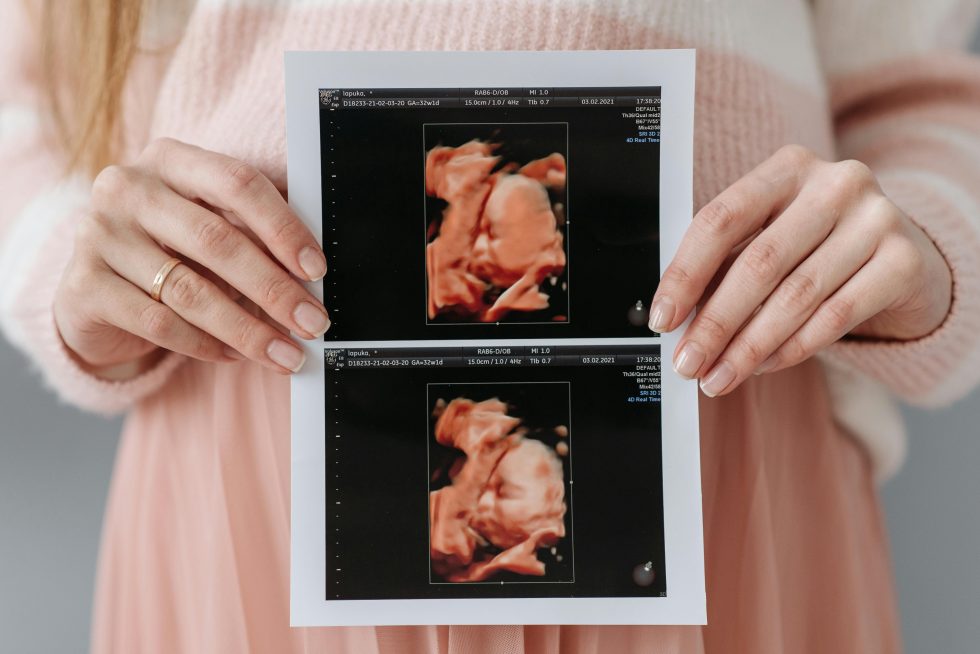 3D & 4D Scan | Sonocare Diagnostics